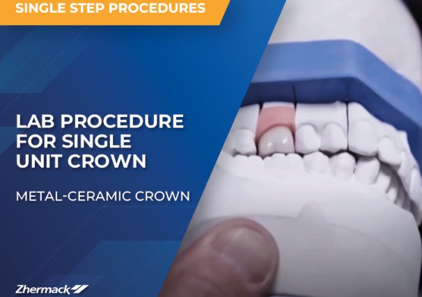 Zhermack Dental Lab Procedure for Single Unit Crown | Metal-Ceramic ...