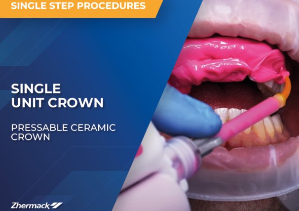 Zhermack Dental Clinical and Laboratory Procedure for Single Unit Crown ...