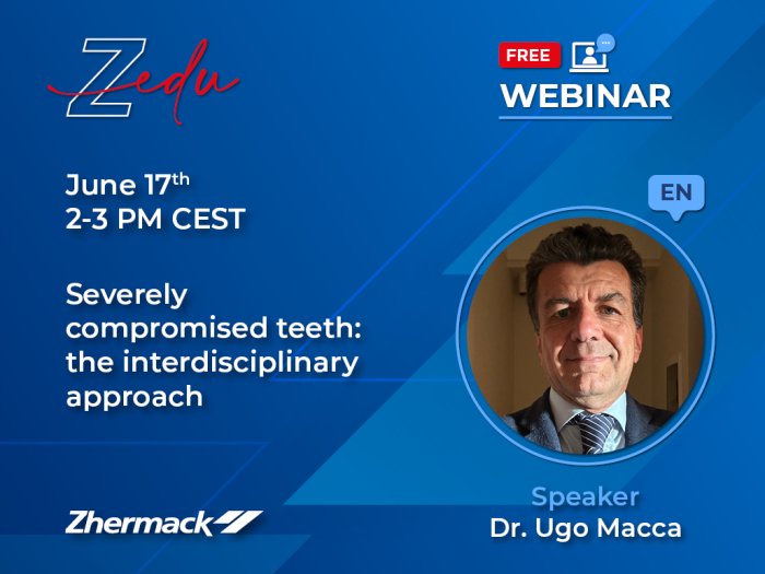 Zhermack webinar | Integrated prosthetic-orthodontic approach through ...